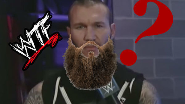12 Wtf Moments From Wwe Smackdown Live Oct 25 Page 11
